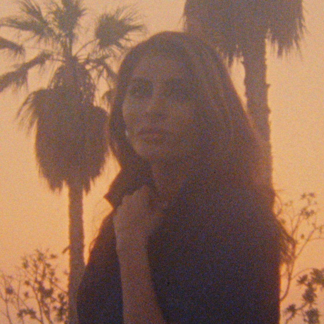 Rosemin Madhavji Hair Transformation | Harklinikken US – Hårklinikken US